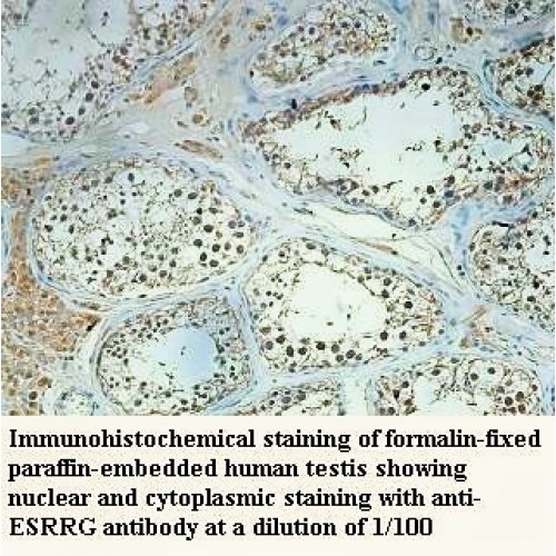 ESRRG Antibody Supplier | CAS | AOBIOUS
