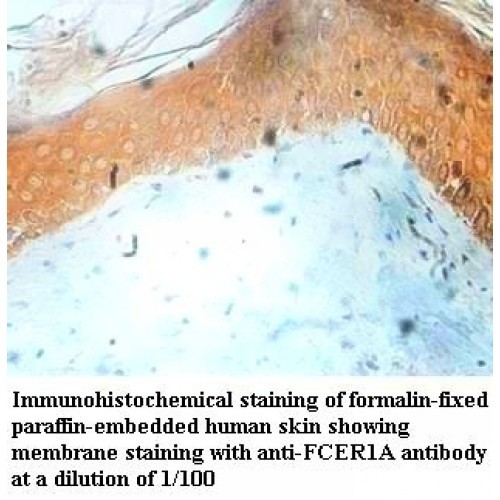 FCER1A Antibody Supplier | CAS | AOBIOUS