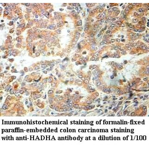 HADHA Antibody Supplier | CAS | AOBIOUS