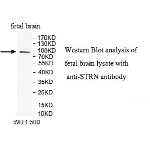 STRN Antibody Supplier | CAS | AOBIOUS