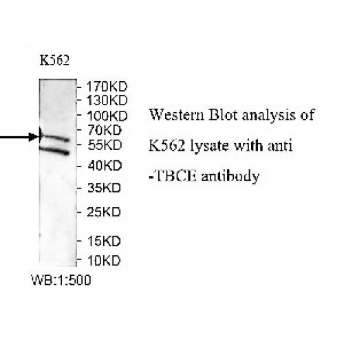 TBCE Antibody Supplier | CAS | AOBIOUS